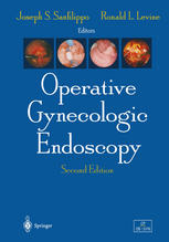 Operative Gynecologic Endoscopy | Kurt Semm (auth.), Joseph S ...