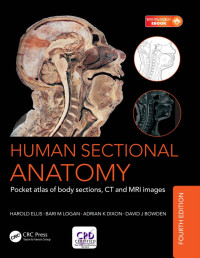 Human sectional anatomy : atlas of body sections, CT and MRI images ...
