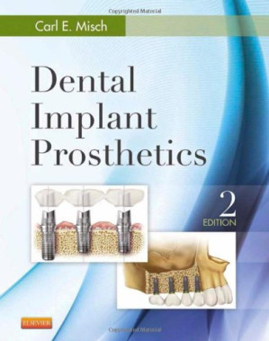 Dental Implant Prosthetics Pageburst E-book On Kno Retail Passcode ...