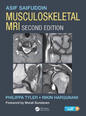 Musculoskeletal MRI : a rapid reference guide - Anna’s Archive